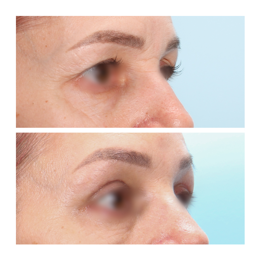 Veido operacijos- fi clinica