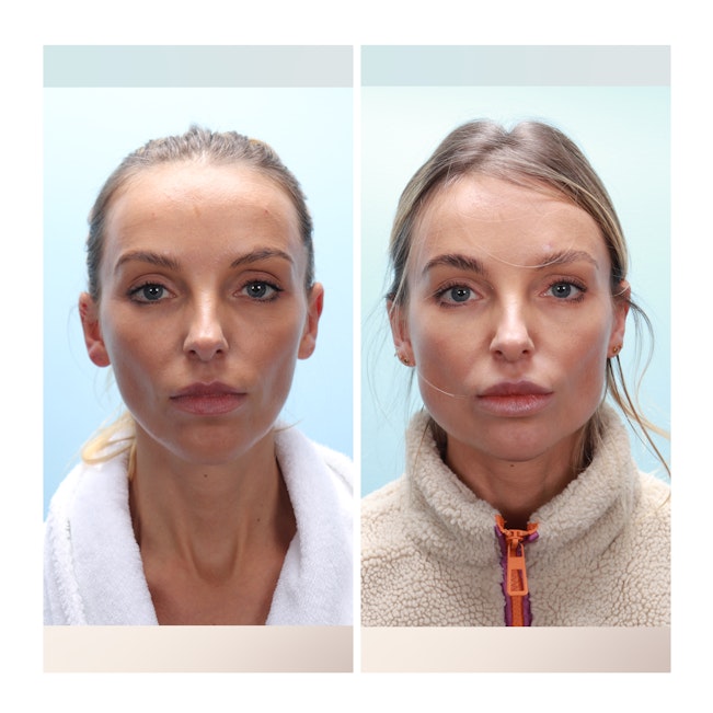 Veido operacijos- fi clinica