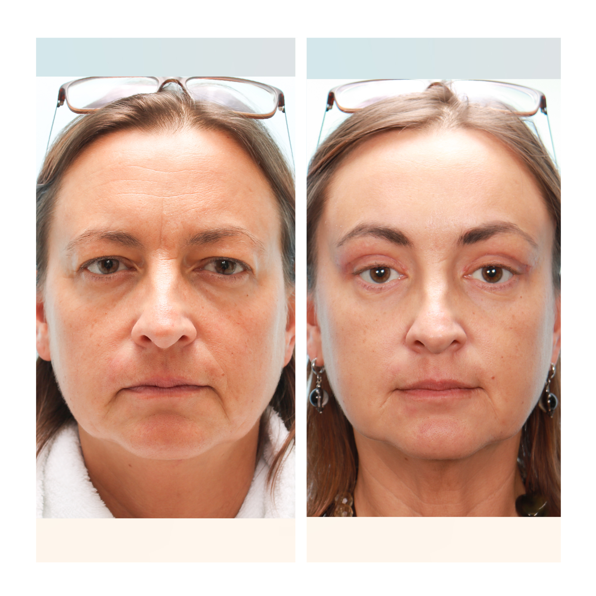 Veido operacijos- fi clinica