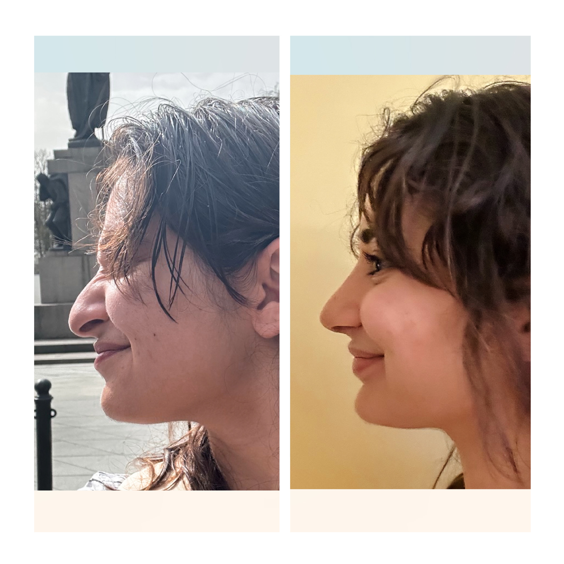 Veido operacijos- fi clinica