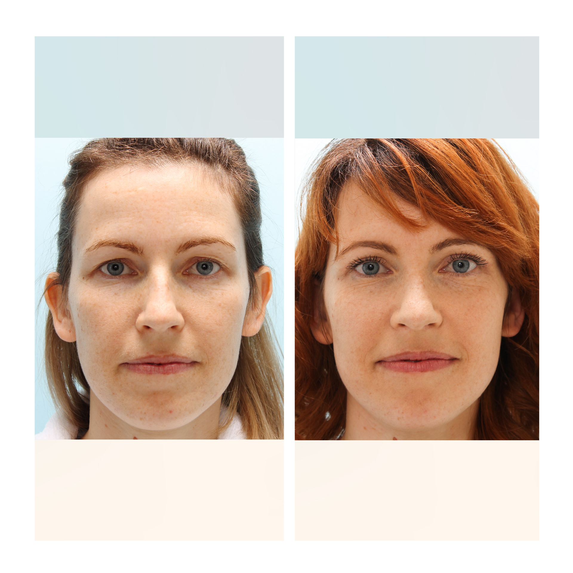 Veido operacijos- fi clinica