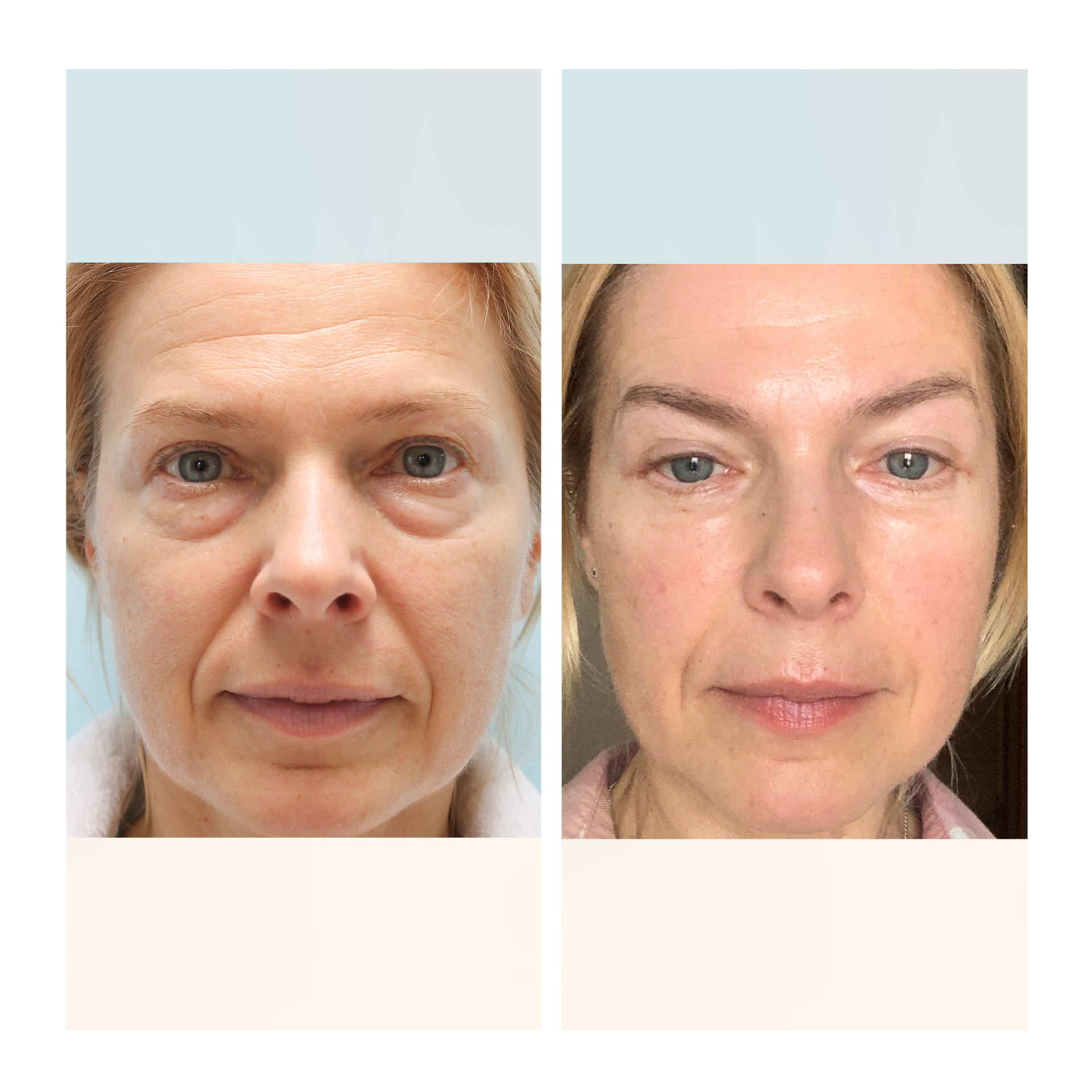 Veido operacijos- fi clinica