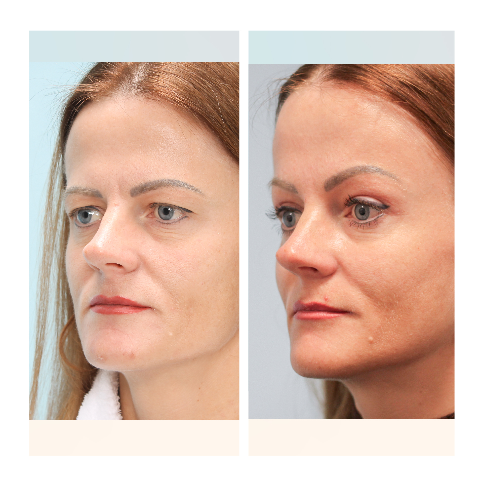 Veido operacijos- fi clinica