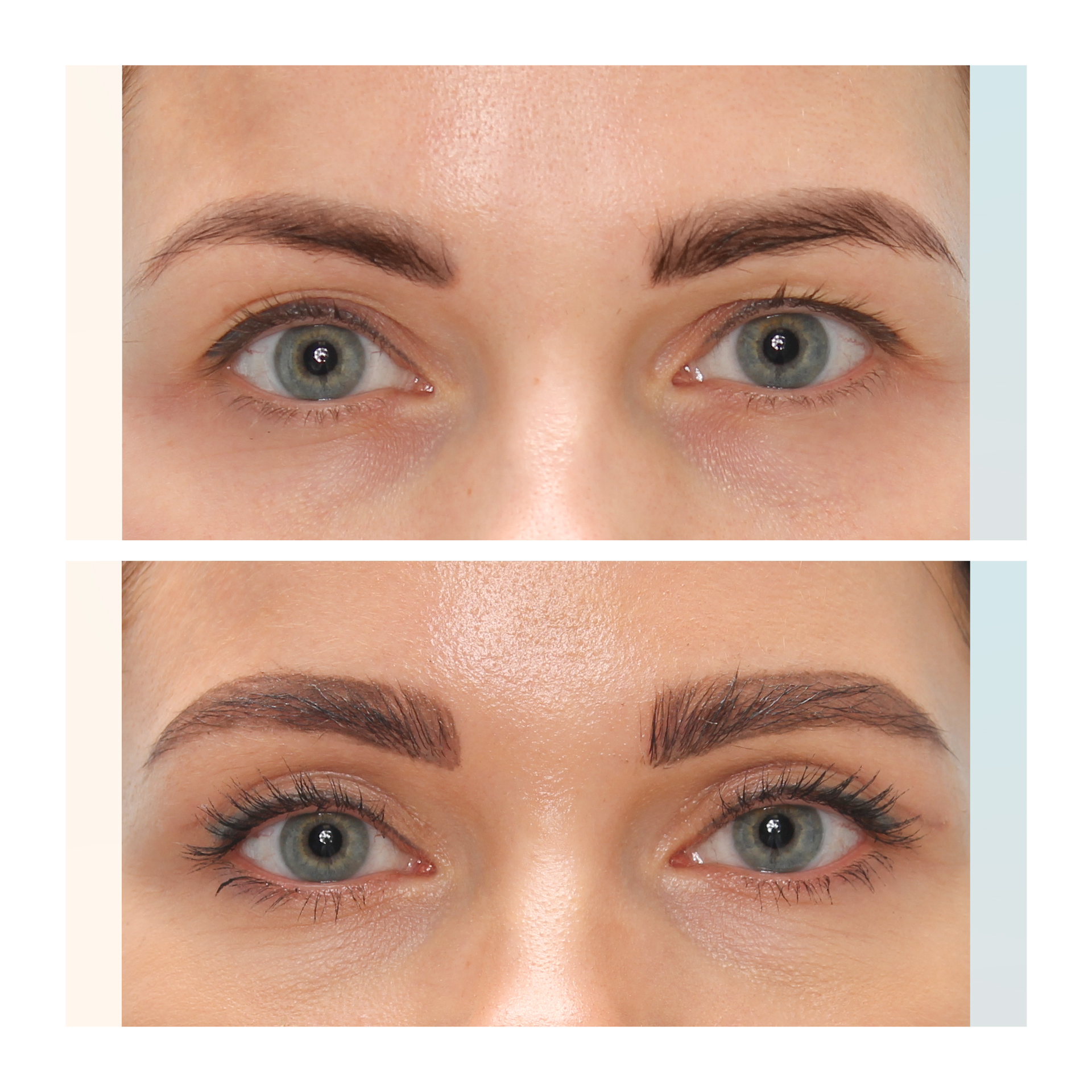 Veido operacijos- fi clinica