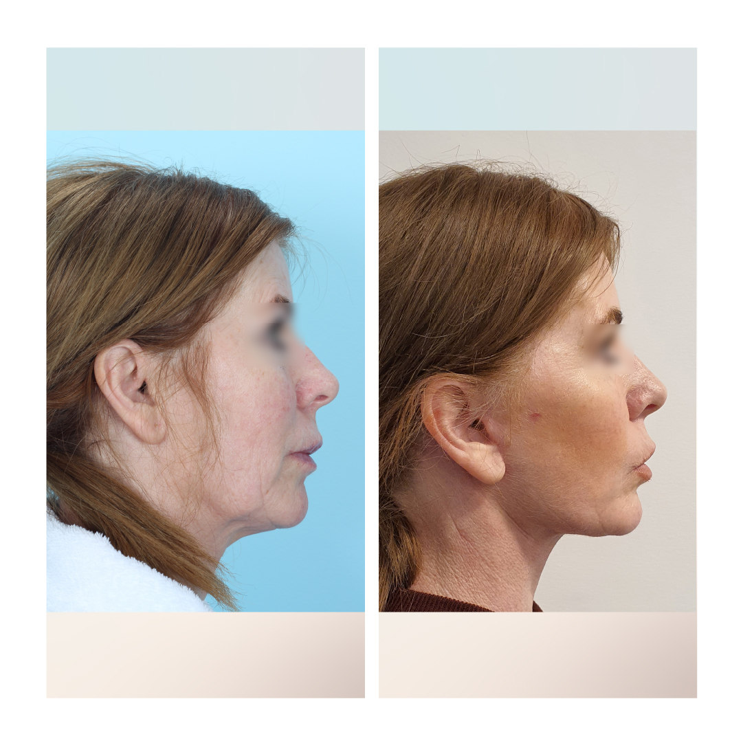 Veido operacijos- fi clinica