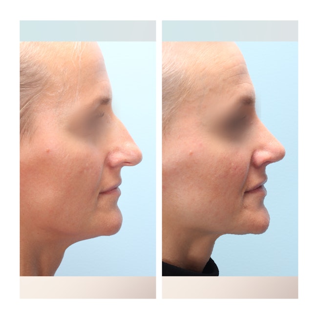 Veido operacijos- fi clinica